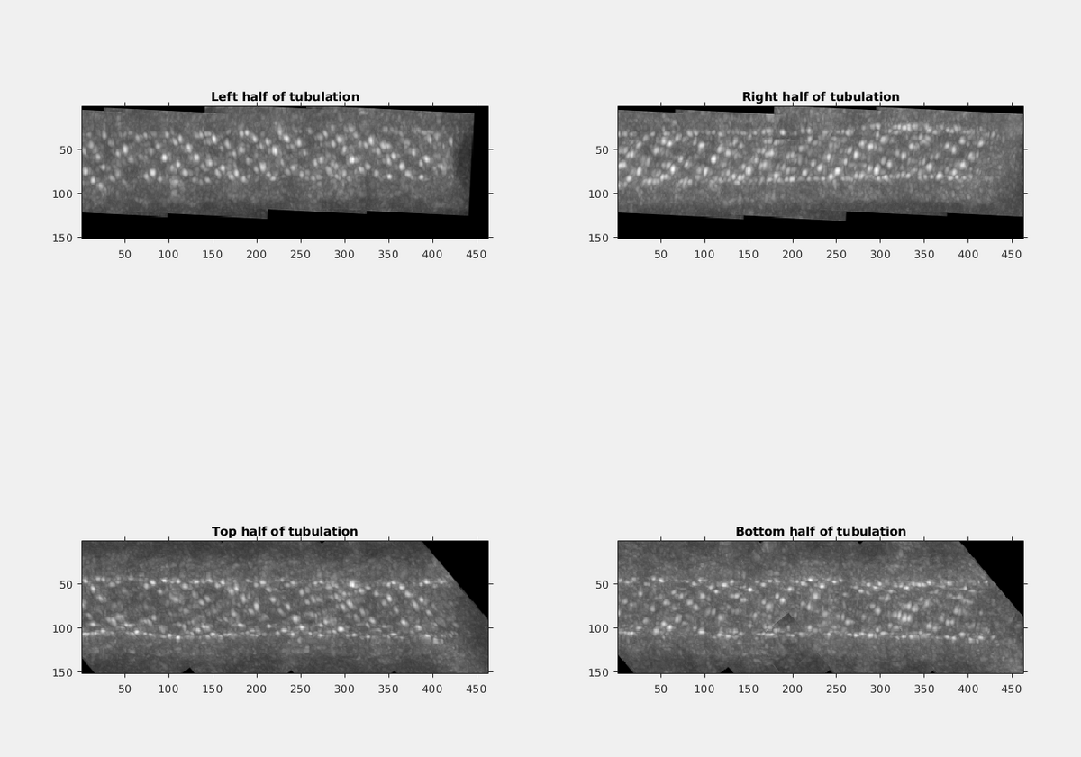 File:Maximum intensity projections tube XYZ.png - Dynamo